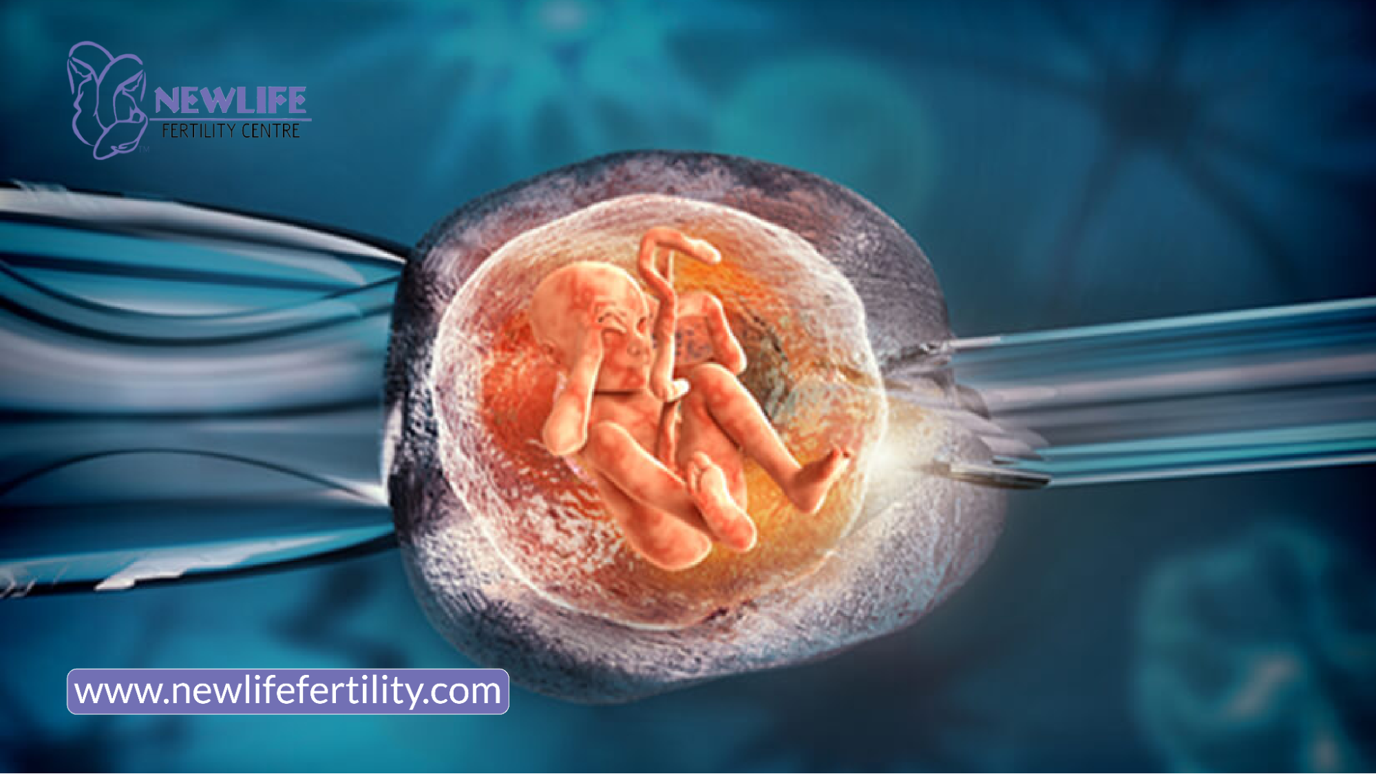 Lupron and IVF: Benefits, Success Rates & Protocol Guide