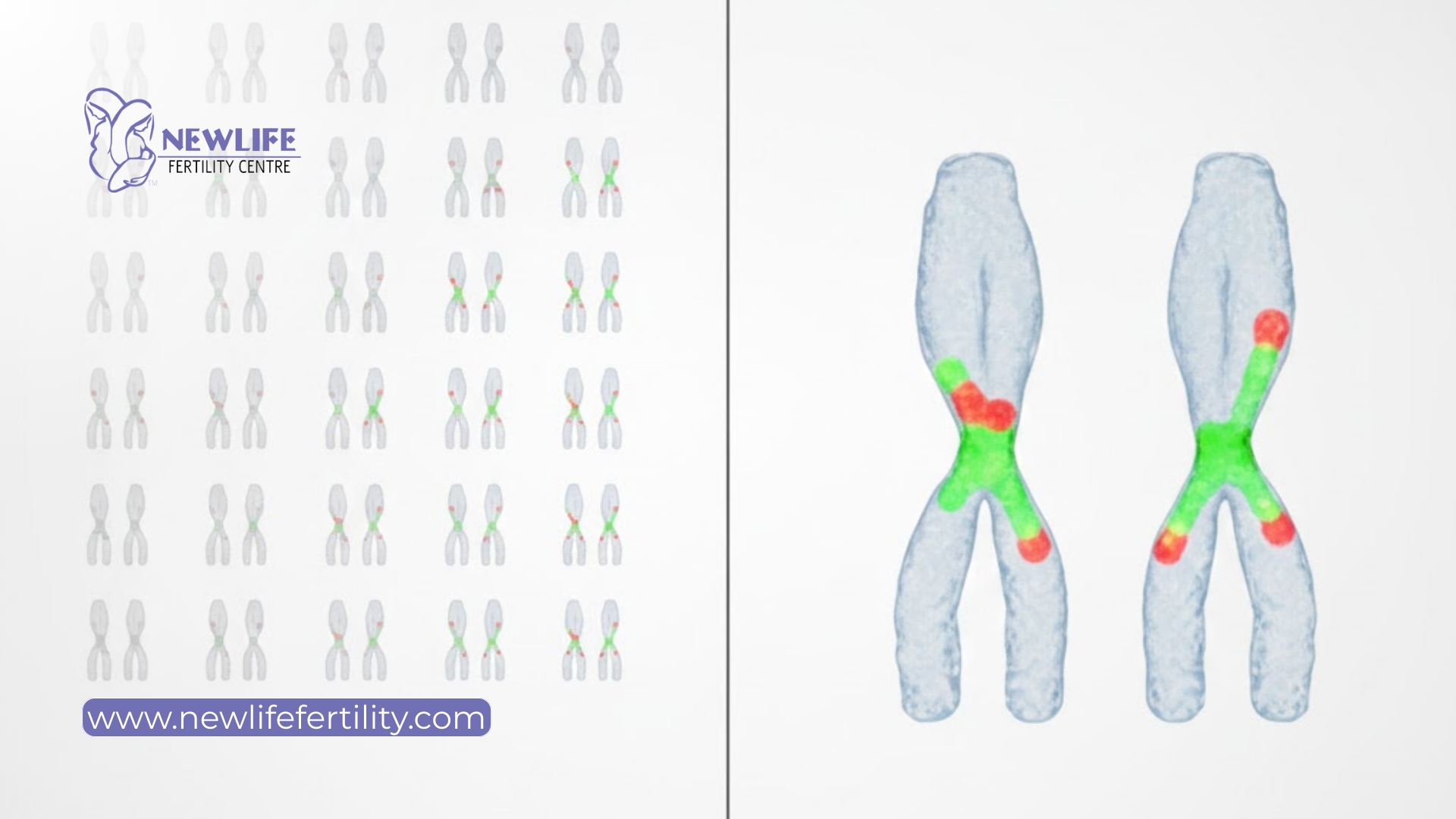 Karyotype Test: Everything You Need to Know